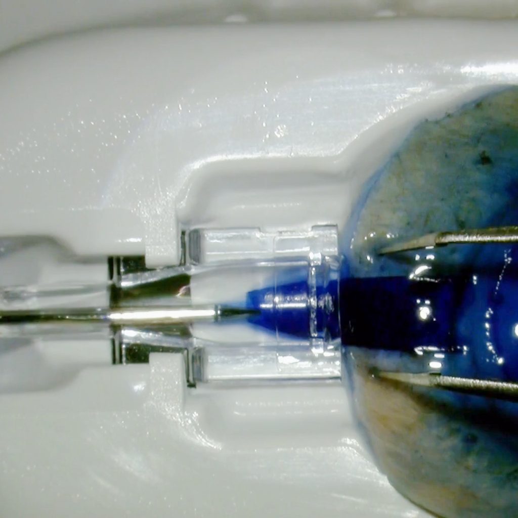 DMEK Step-by-Step-Anleitung - GVBM mbH